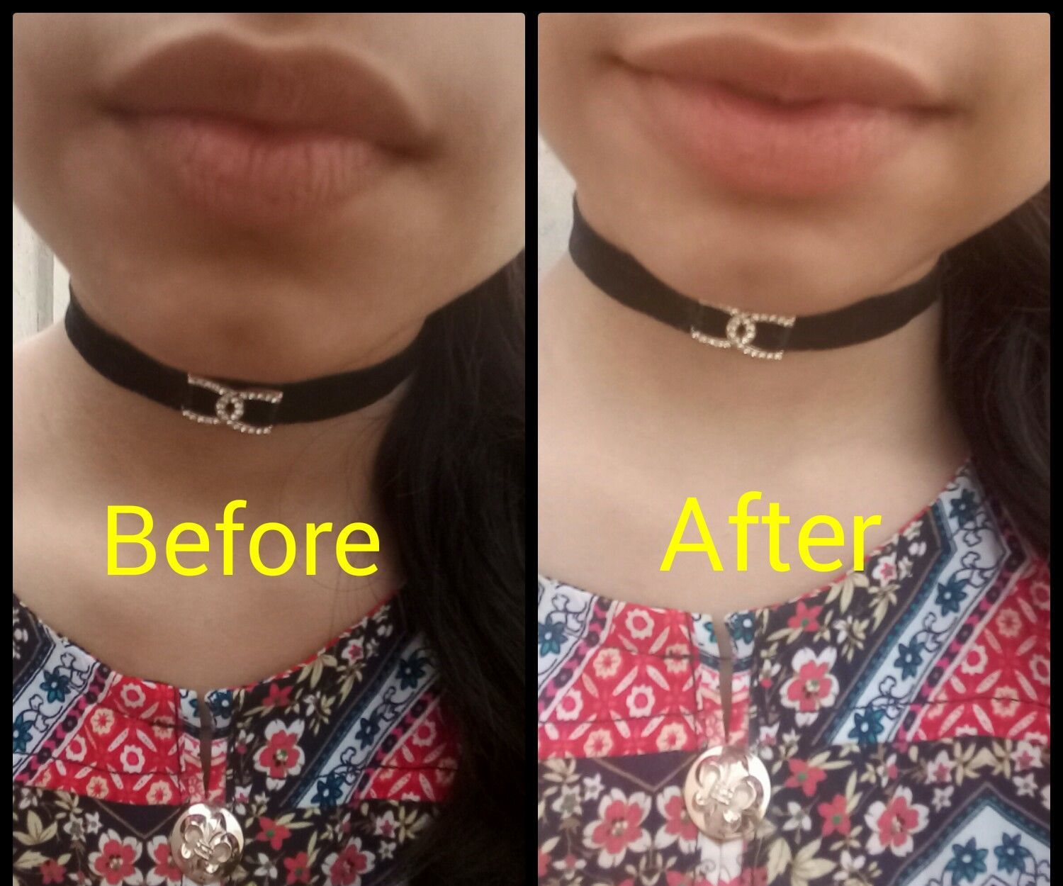 DIY Spa-Style Lip Therapy at Home!! Step by Step Treatment for Chapped ...