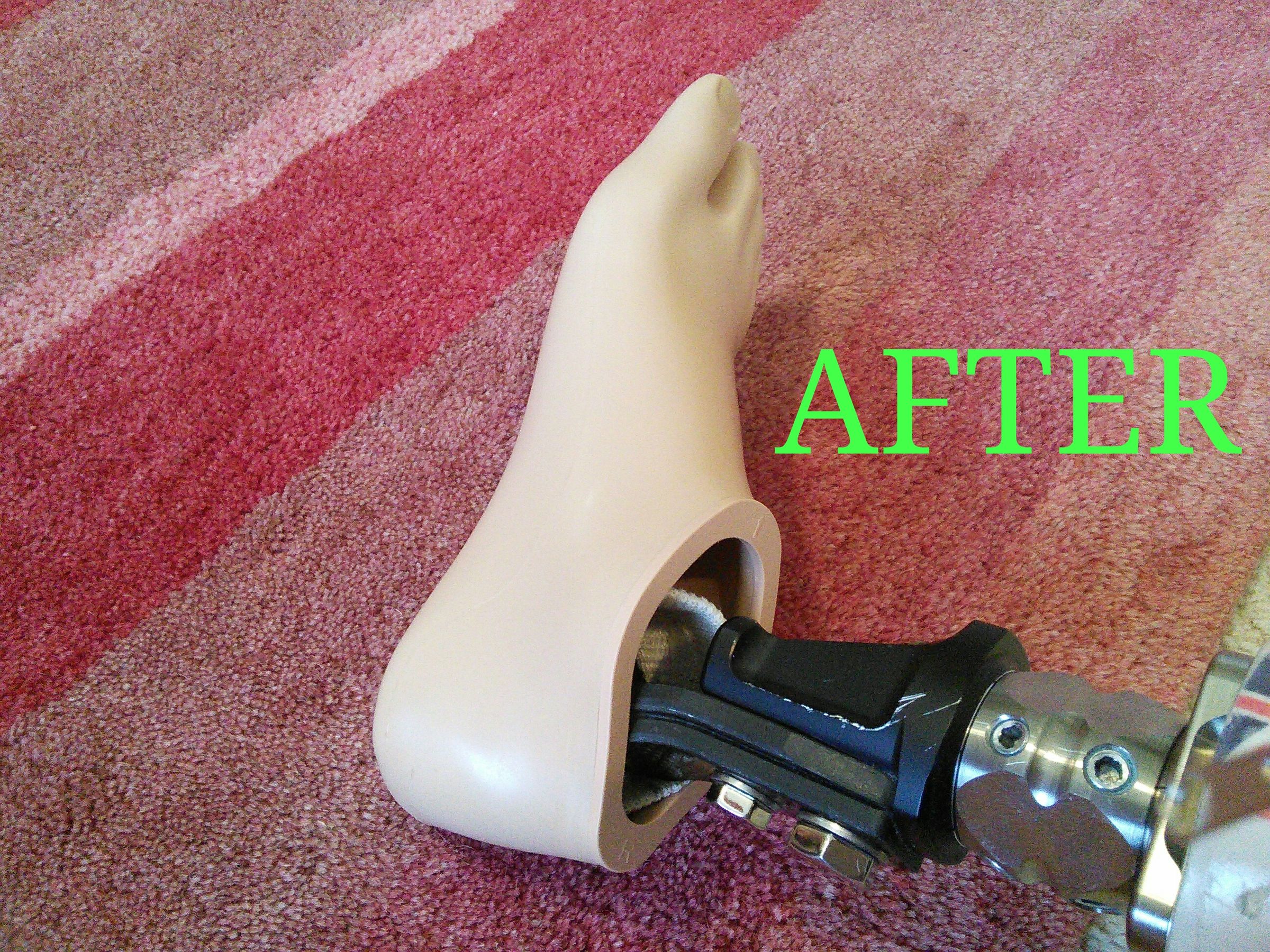 How to Put a New Foot on Your Prosthesis. : 9 Steps - Instructables