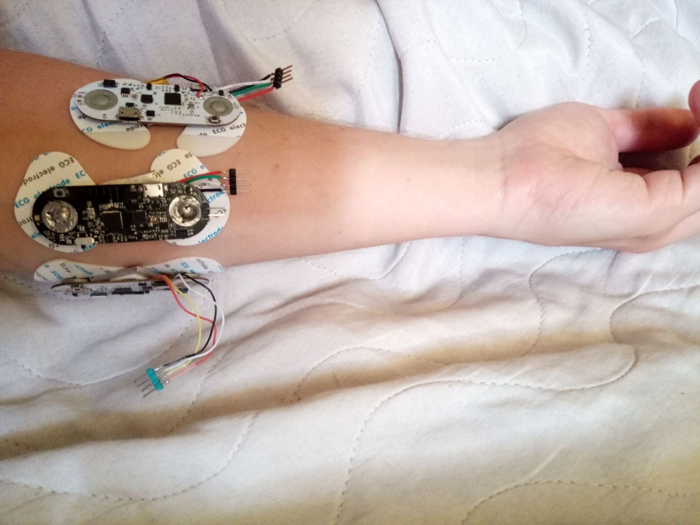 Robotic Hand Control With EMG : 7 Steps - Instructables
