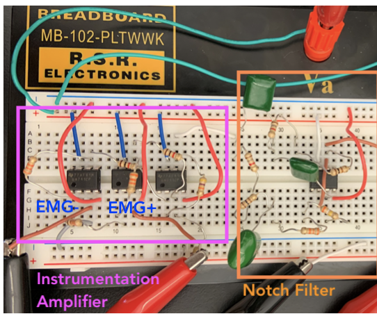 Easy Automated ECG (1 Amplifier, 2 Filters) : 7 Steps - Instructables