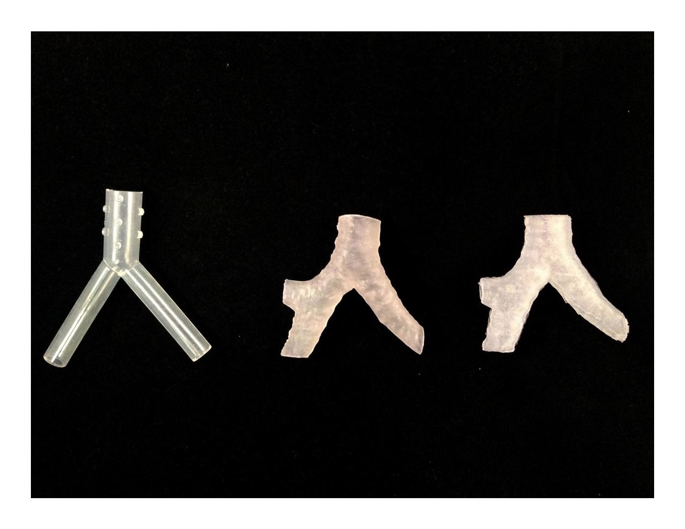 Create a Custom 3D Printable Prosthetic Device Using Data From a CT ...