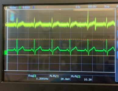 How to Make an Electrocardiogram (ECG) : 7 Steps - Instructables