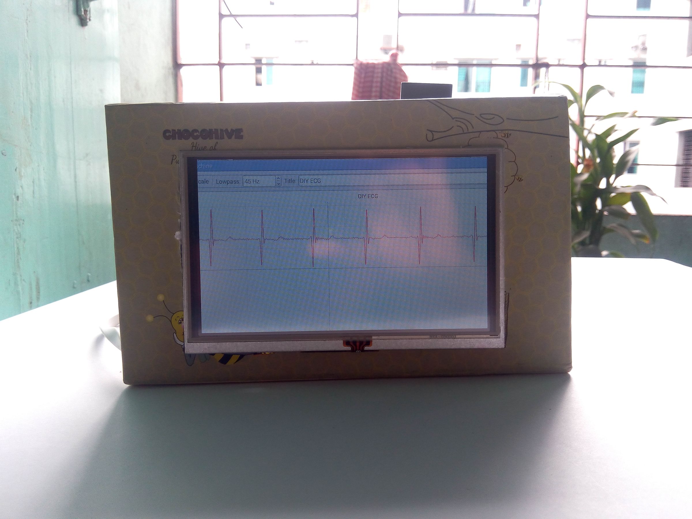 Portable ECG Machine : 9 Steps (with Pictures) - Instructables