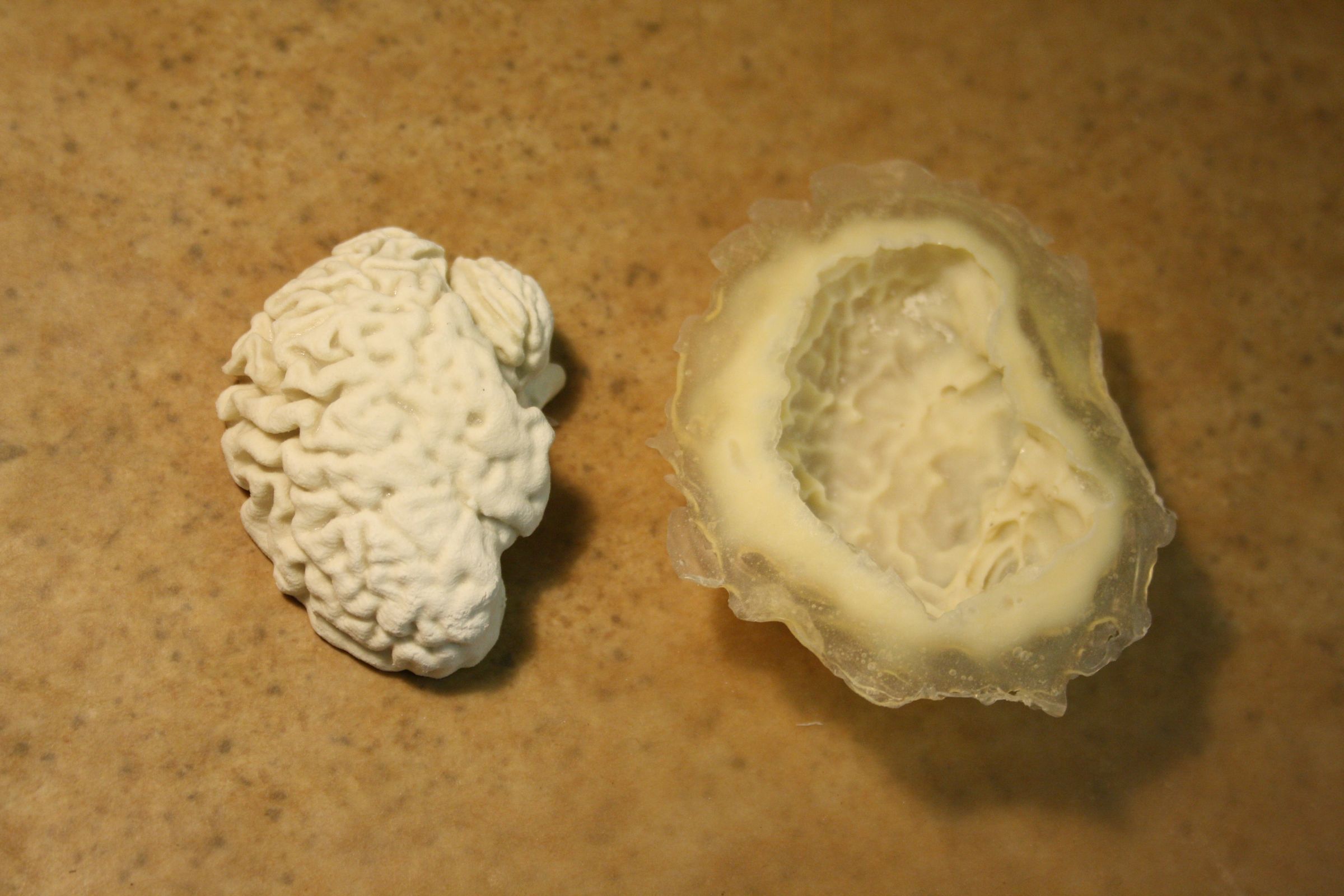 Edible Chocolate Brain From MRI Scan : 9 Steps (with Pictures ...