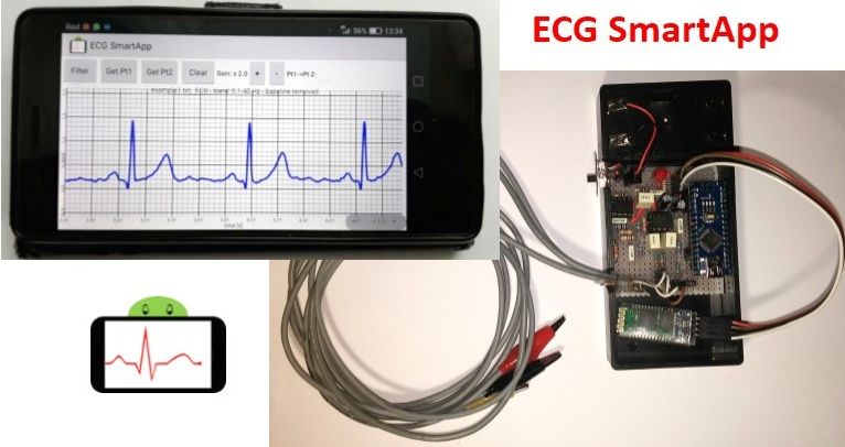 How to Build a Low Cost ECG Device : 27 Steps - Instructables