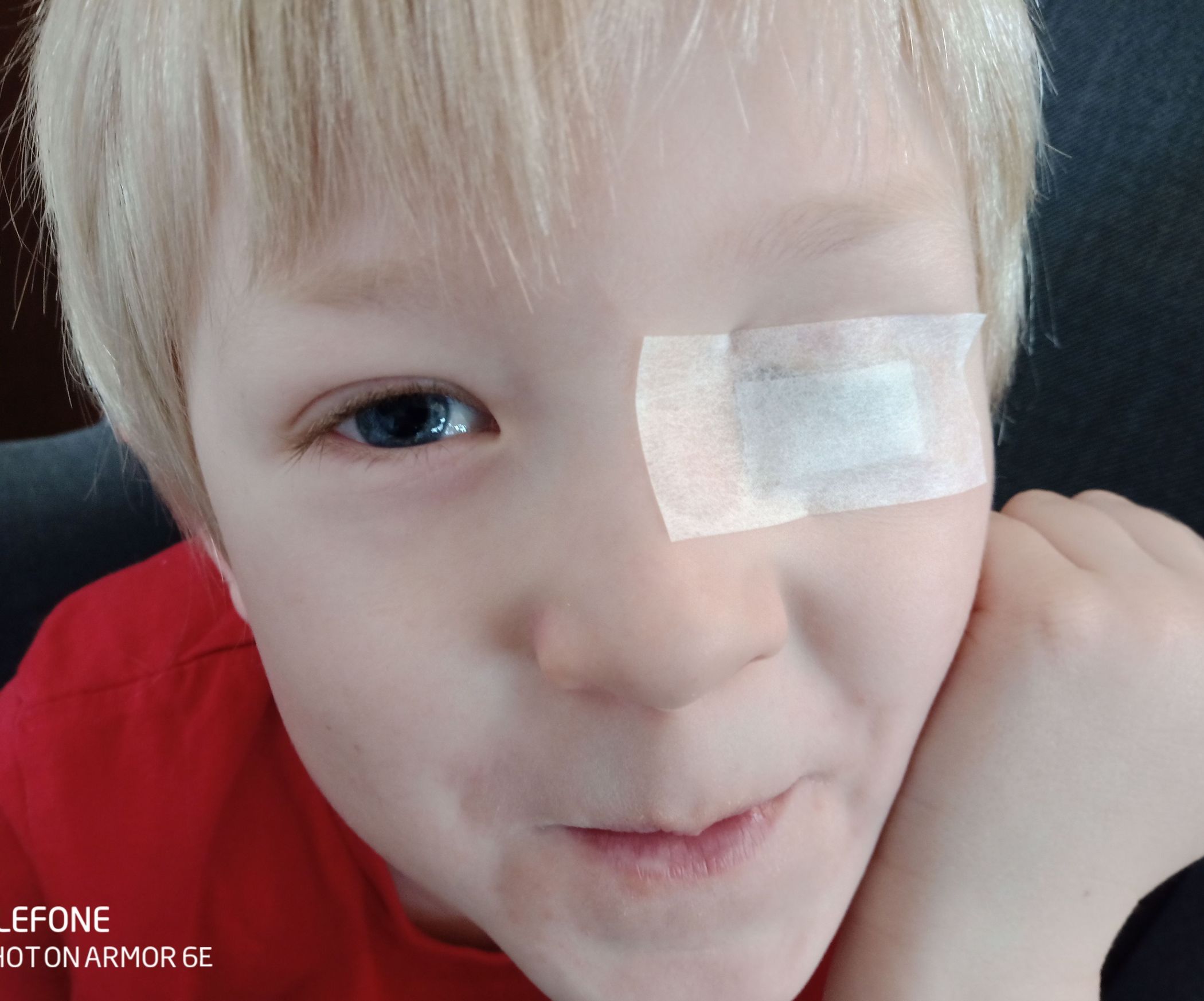 Easy Amblyopia Eye Patch - and Teaching Kids Money Saving : 6 Steps ...