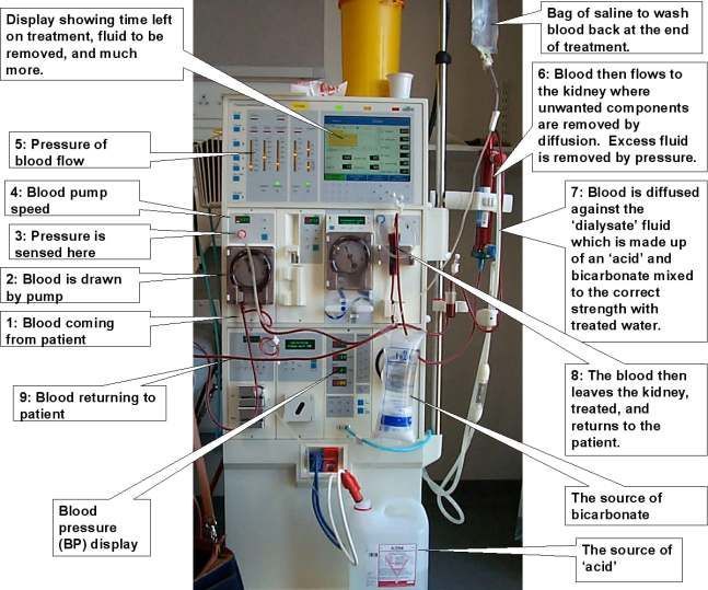 How to String a Hemodialysis Machine - Instructables