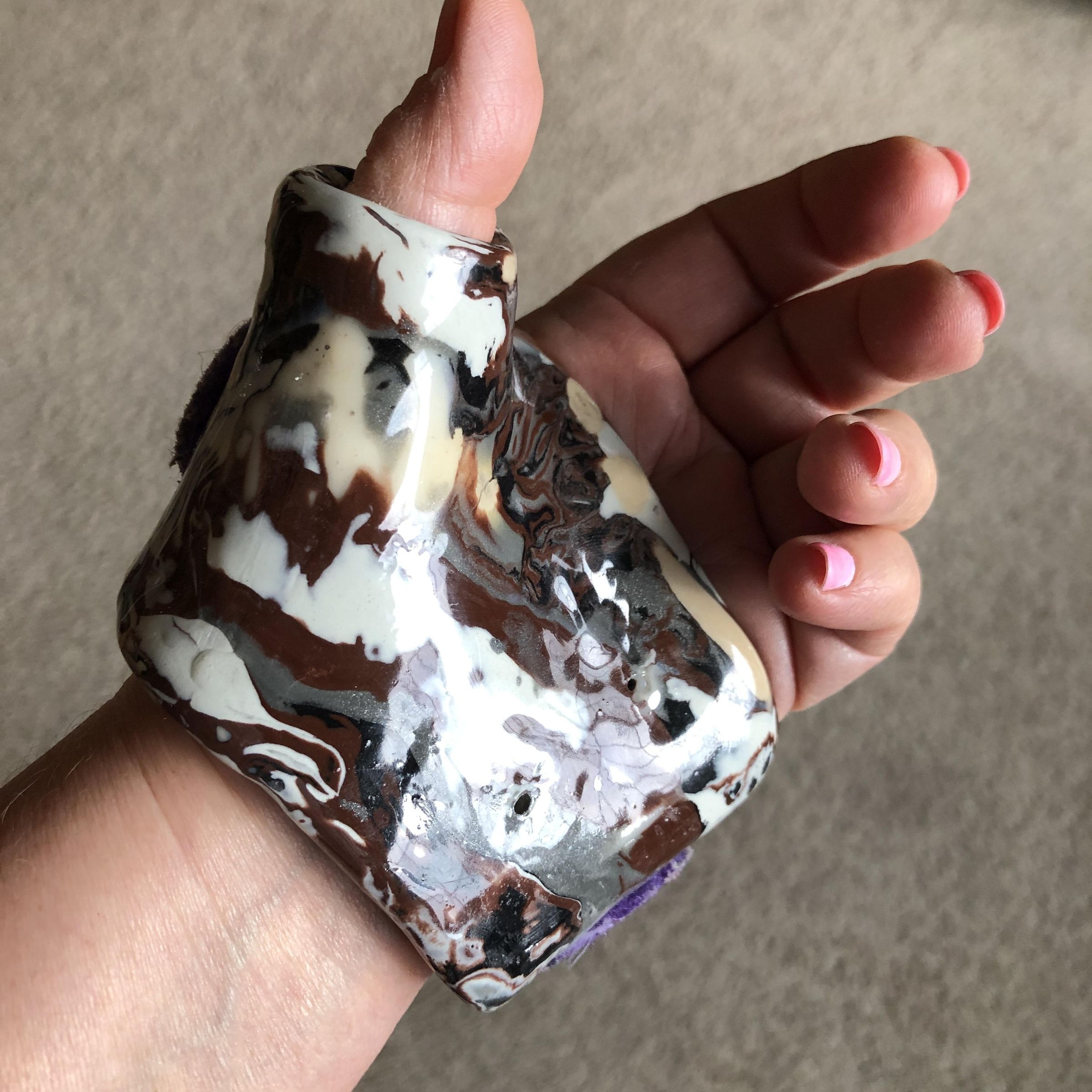 Orthopedic Brace or Splint Repair & Custom Upgrade : 12 Steps (with ...