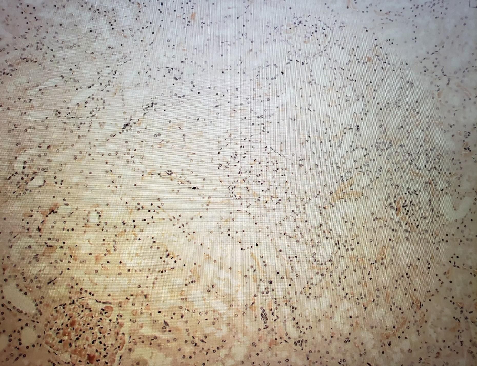 How to Change a Leica and Thermo Stainer : 25 Steps - Instructables