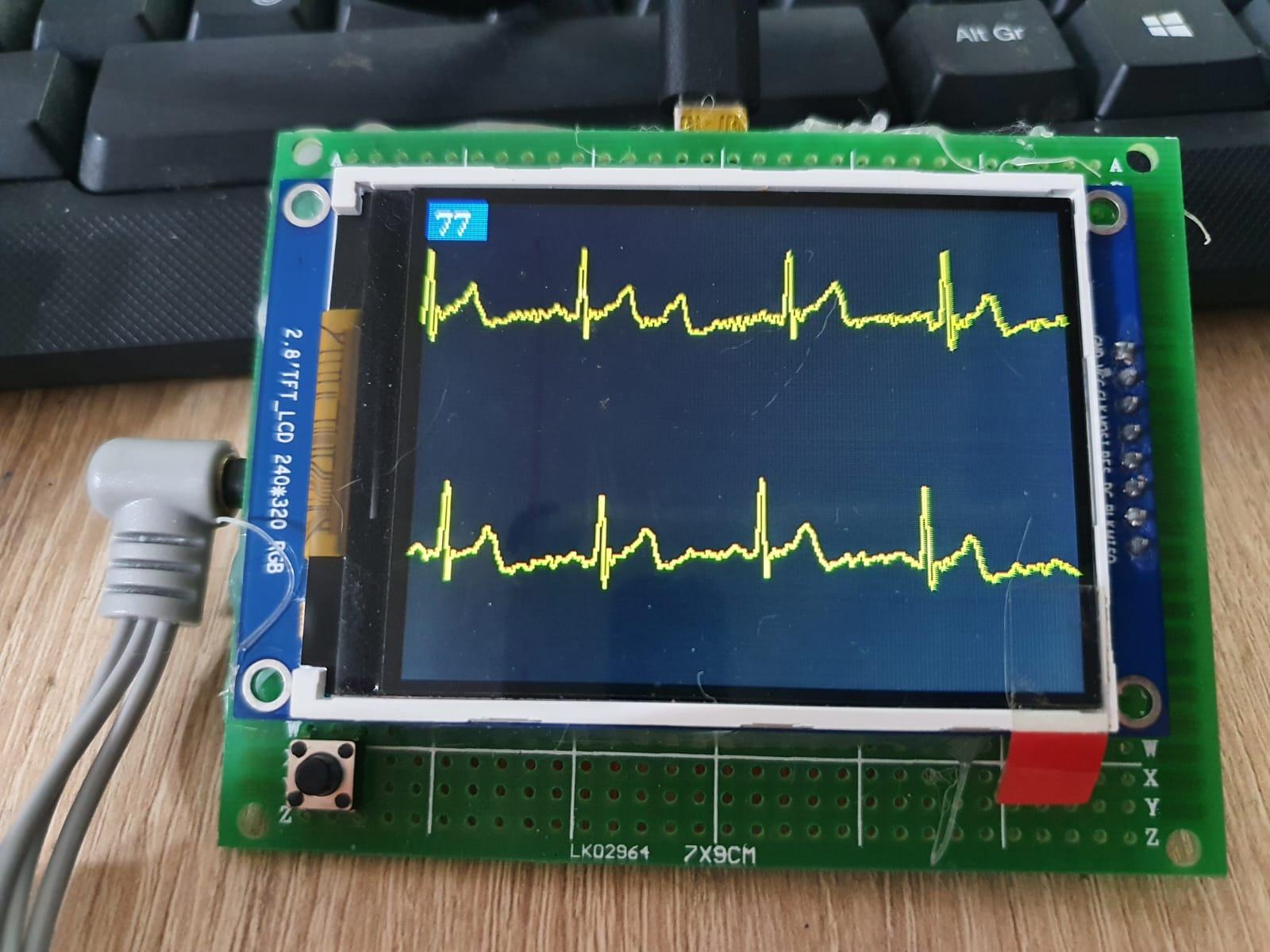 ECG Display With Arduino : 13 Steps (with Pictures) - Instructables