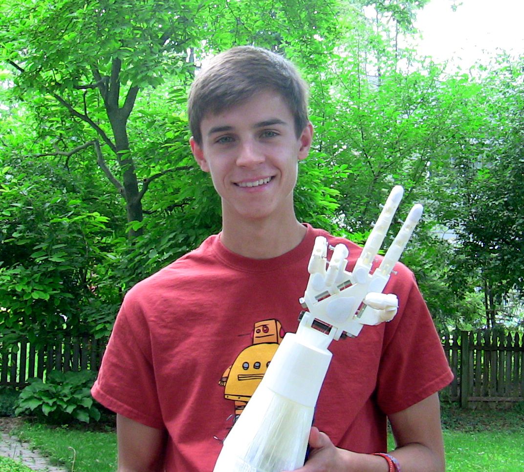 DIY Prosthetic Hand & Forearm (Voice Controlled) : 14 Steps (with ...