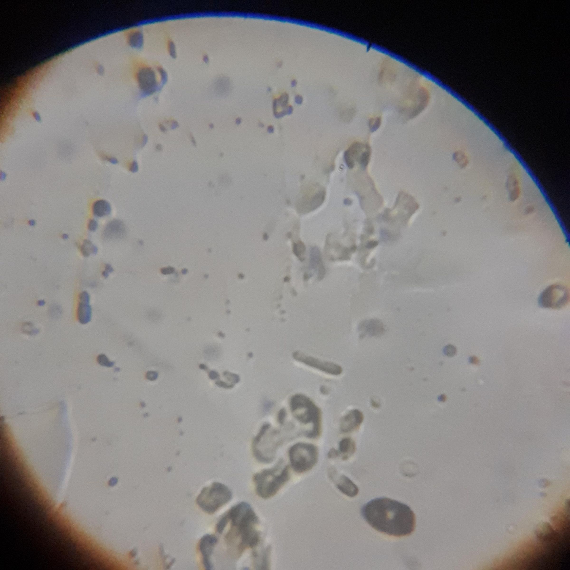 Growing Algae and Then Exposing Them to Gamma Rays. : 5 Steps ...
