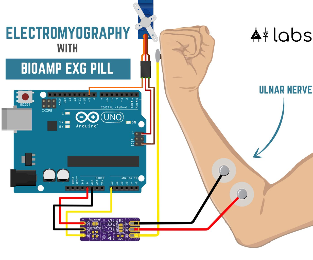 Emg With Arduino Uno R4 Wifi And Diy Neuroscience Kit From Upside Down