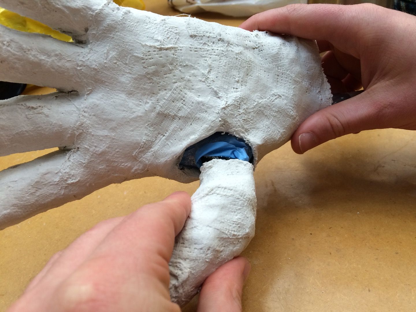 Prosthetic Hand (TfCD) : 8 Steps (with Pictures) - Instructables