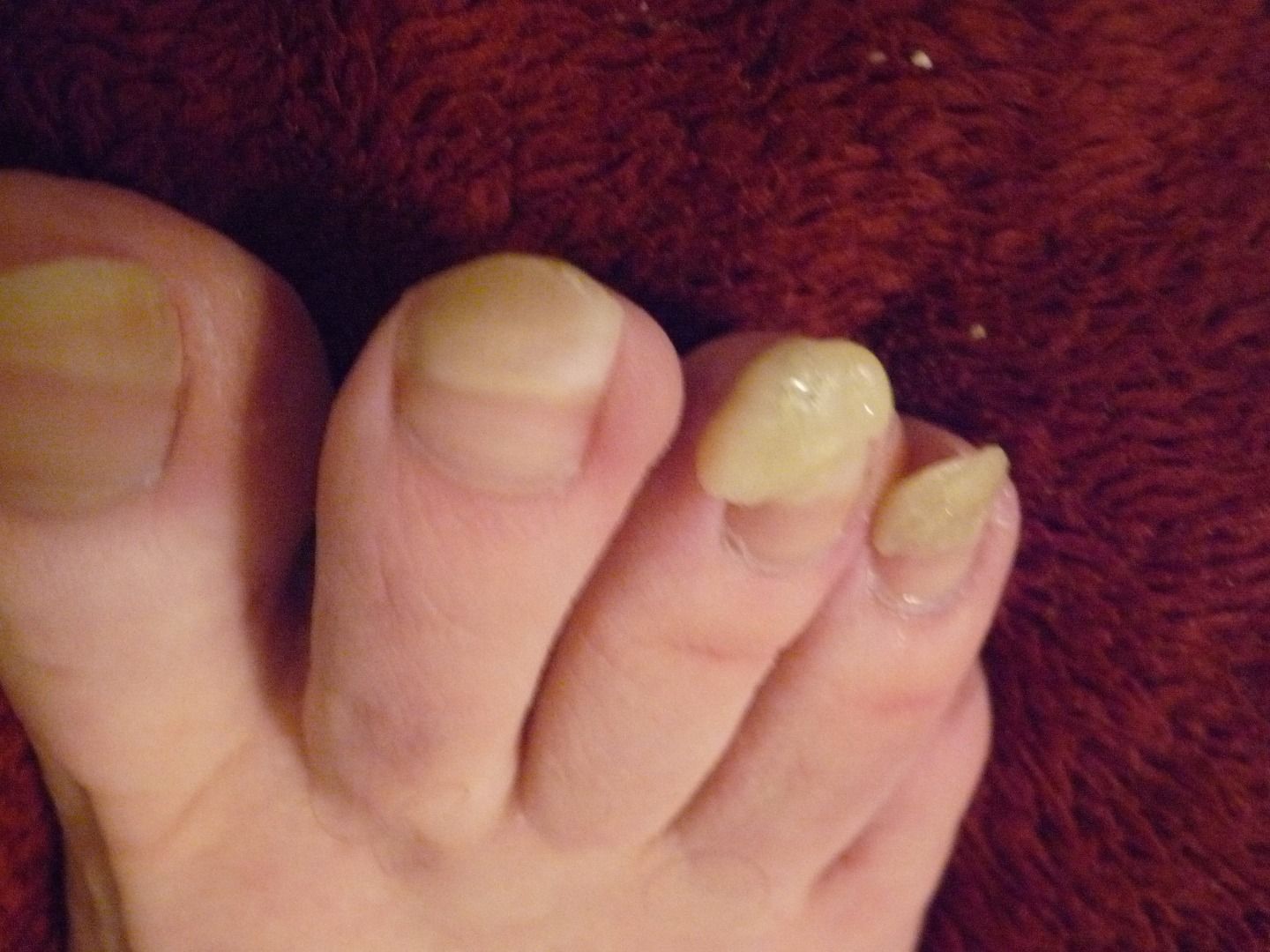 Stop Toenails Scratching/cutting. - Instructables
