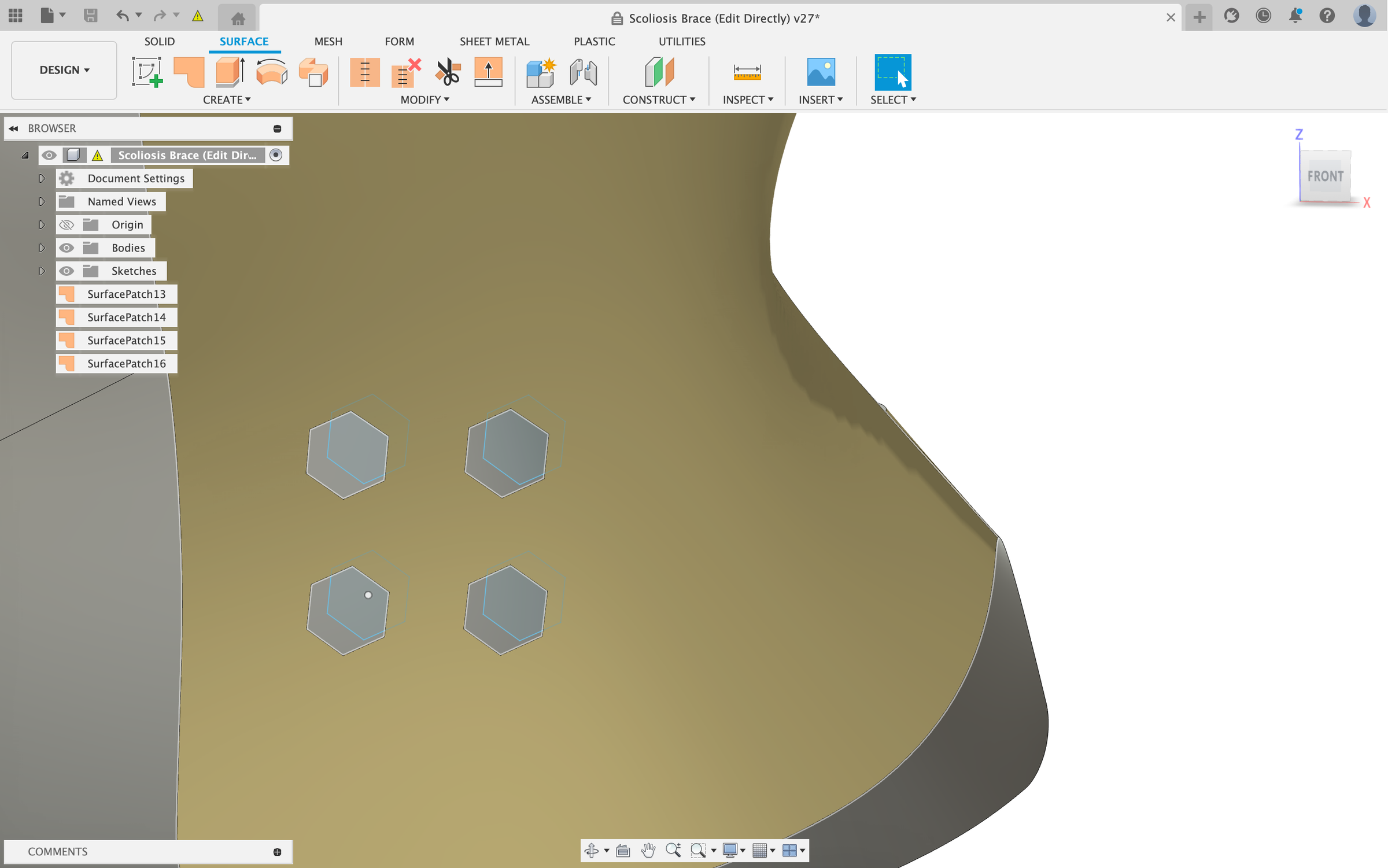 3D Printed Back Brace for Scoliosis : 7 Steps (with Pictures ...