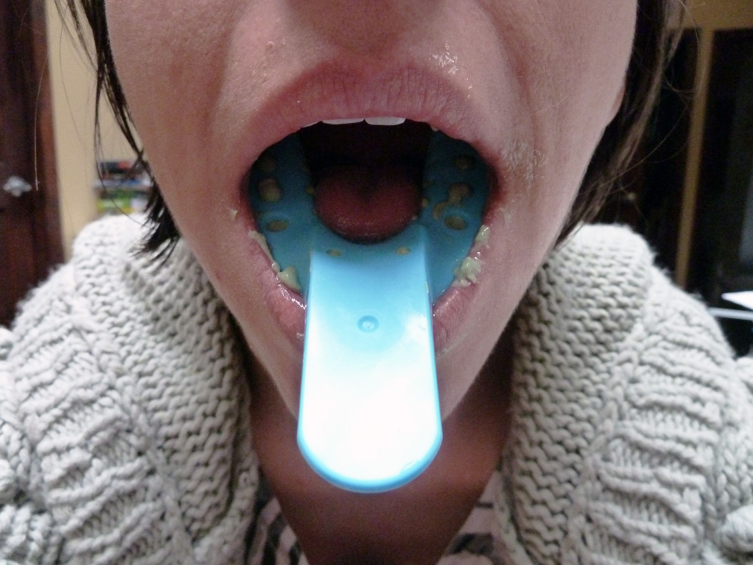 Cast Your Teeth for Halloween : 4 Steps (with Pictures) - Instructables