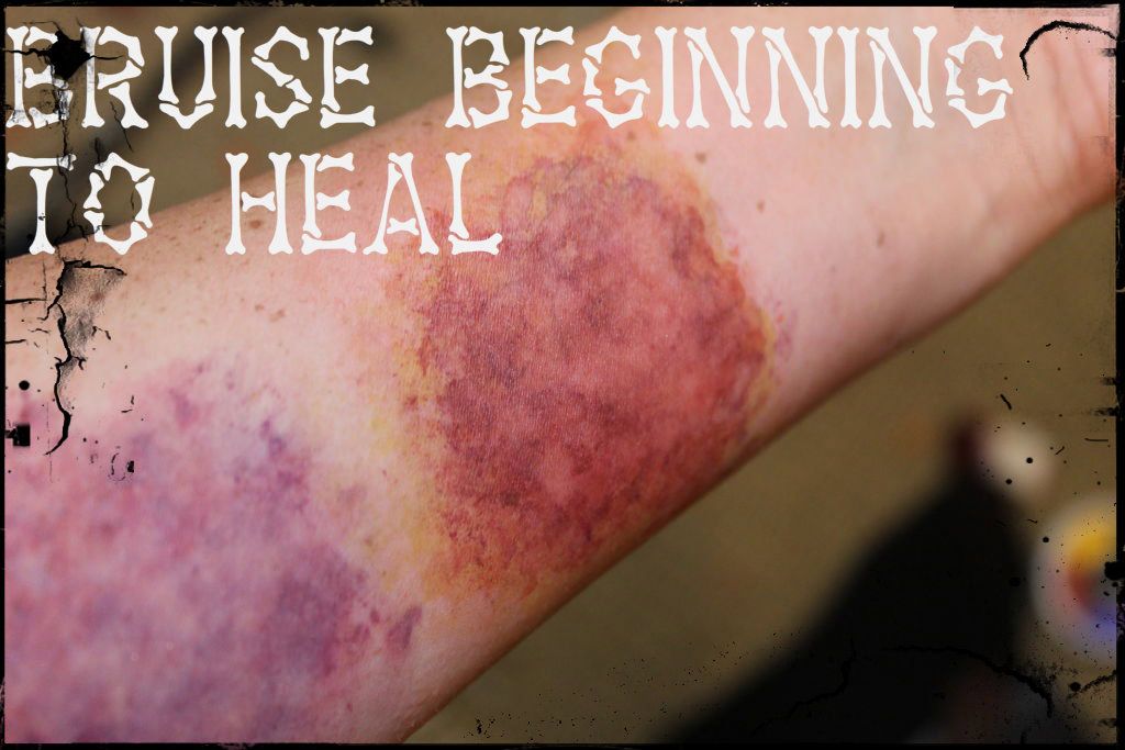 BRUISE MAKEUP : 5 Steps (with Pictures) - Instructables