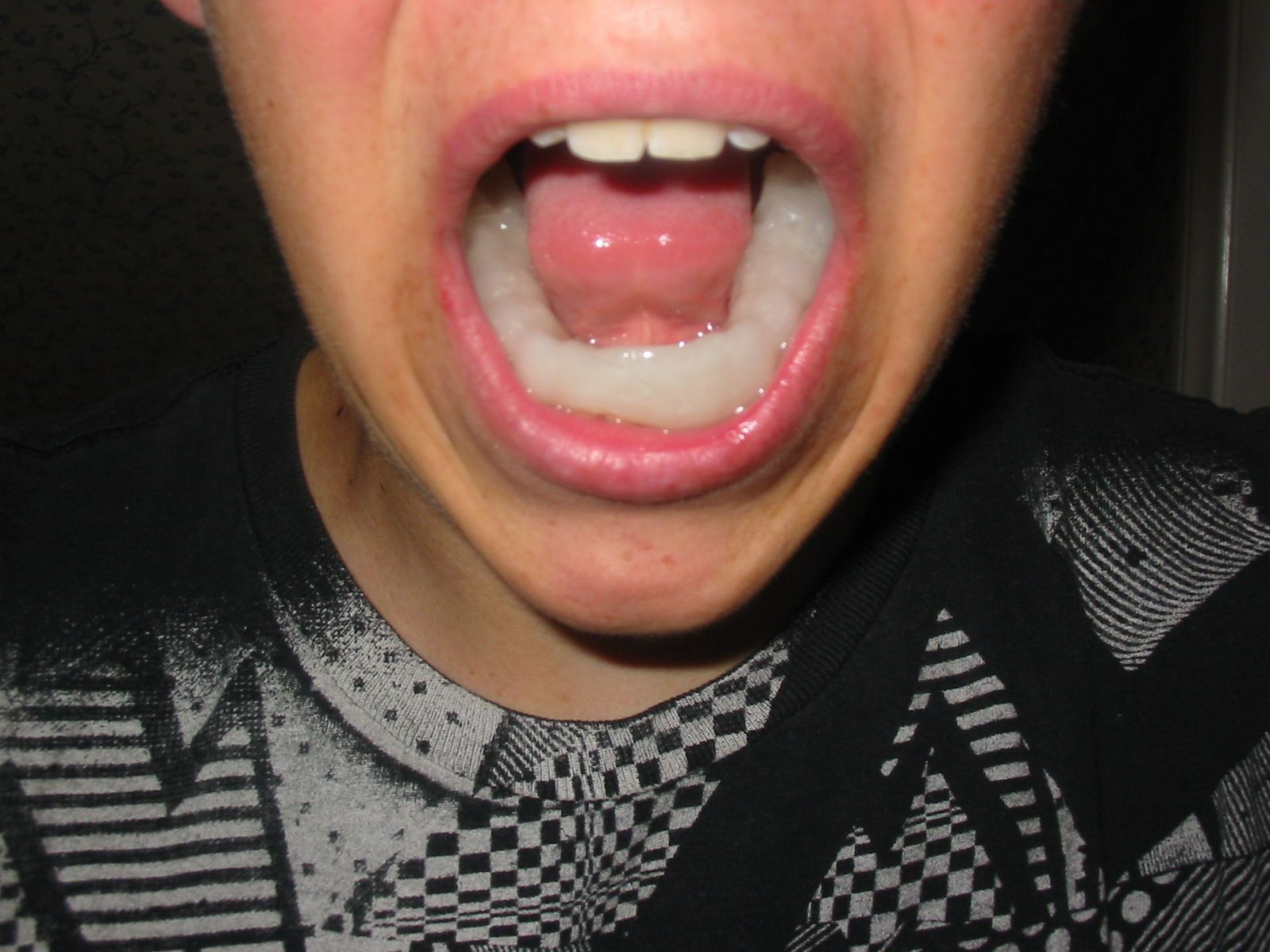 Make a Night Time Orthodontic Retainer : 3 Steps - Instructables