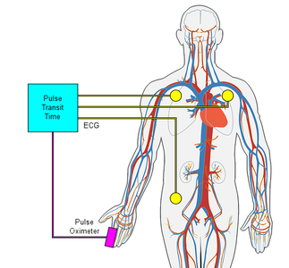 ECG Display With Arduino : 13 Steps (with Pictures) - Instructables
