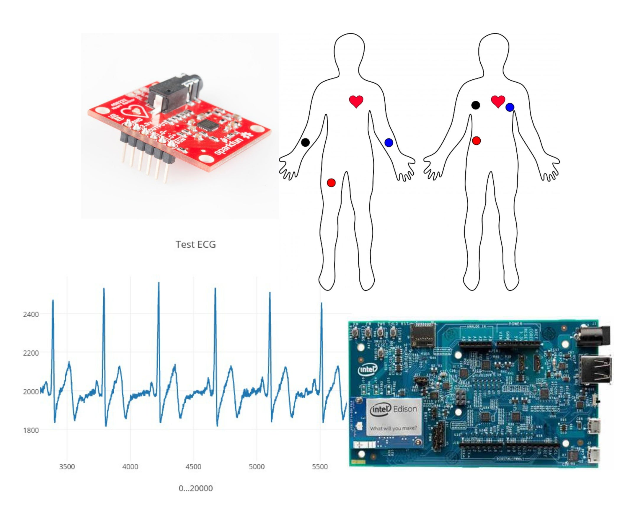 Ecg Using Intel Edison And Plotly 6 Steps Instructables