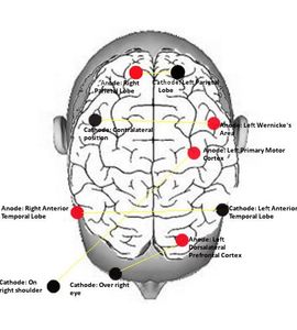 How to Build a Brain Cap (tDCS) : 15 Steps - Instructables
