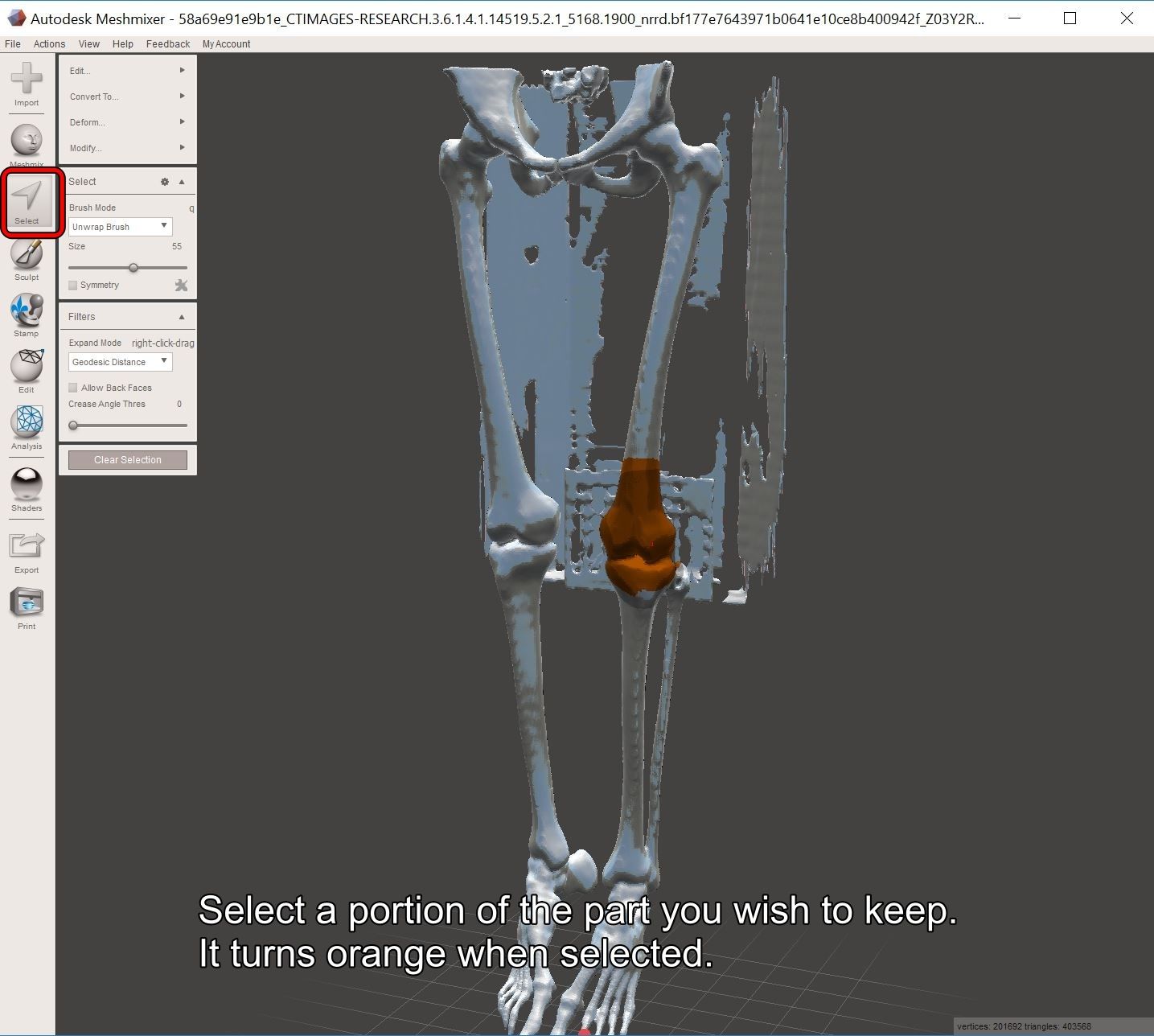 How to Easily and Automatically Convert a CT Scan (DICOM Data) Into a ...
