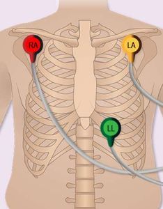 DIY ECG EKG Portable Heart Monitor : 8 Steps (with Pictures ...