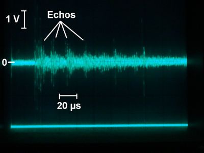 Body-ultrasound Sonography With Arduino : 3 Steps (with Pictures) - Instructables
