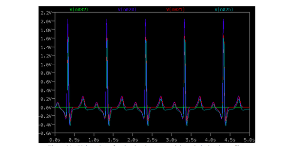 Automated ECG Circuit Simulator : 4 Steps - Instructables