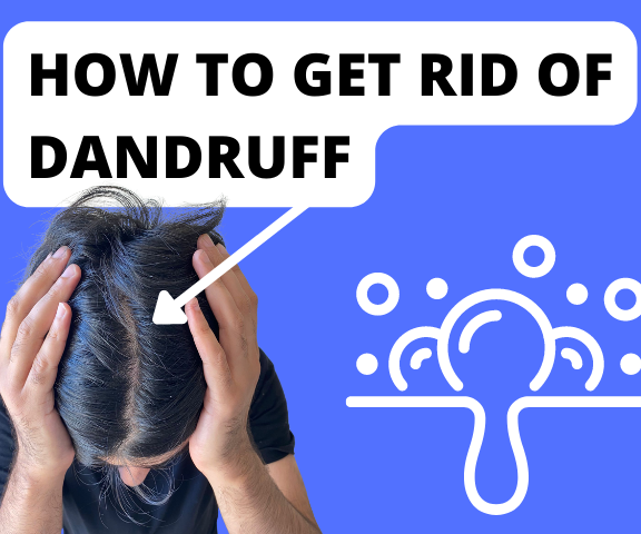 How to Get Rid of Dandruff : 3 Steps - Instructables