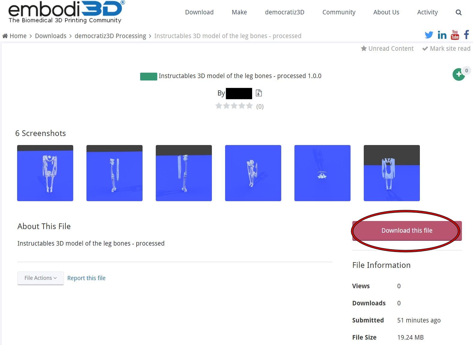 How to Easily and Automatically Convert a CT Scan (DICOM Data) Into a ...