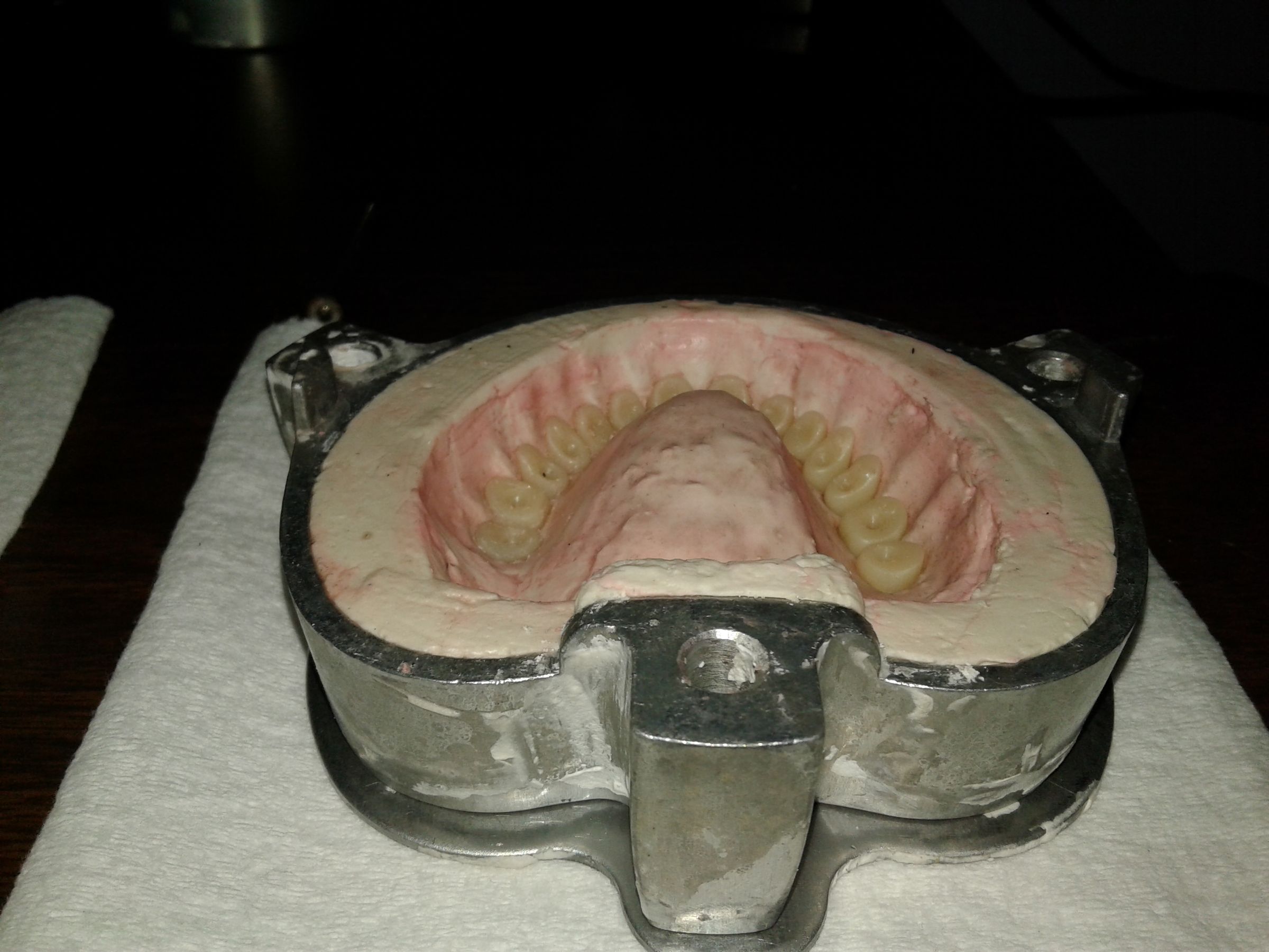 DIY Dentures : a Post-Surgical Plan : 12 Steps (with Pictures ...