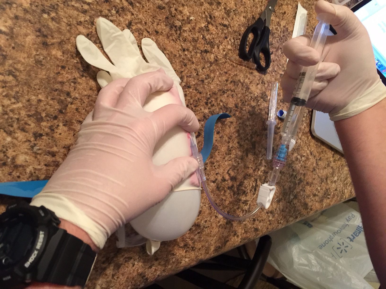 How to Insert a Saline Lock : 12 Steps - Instructables