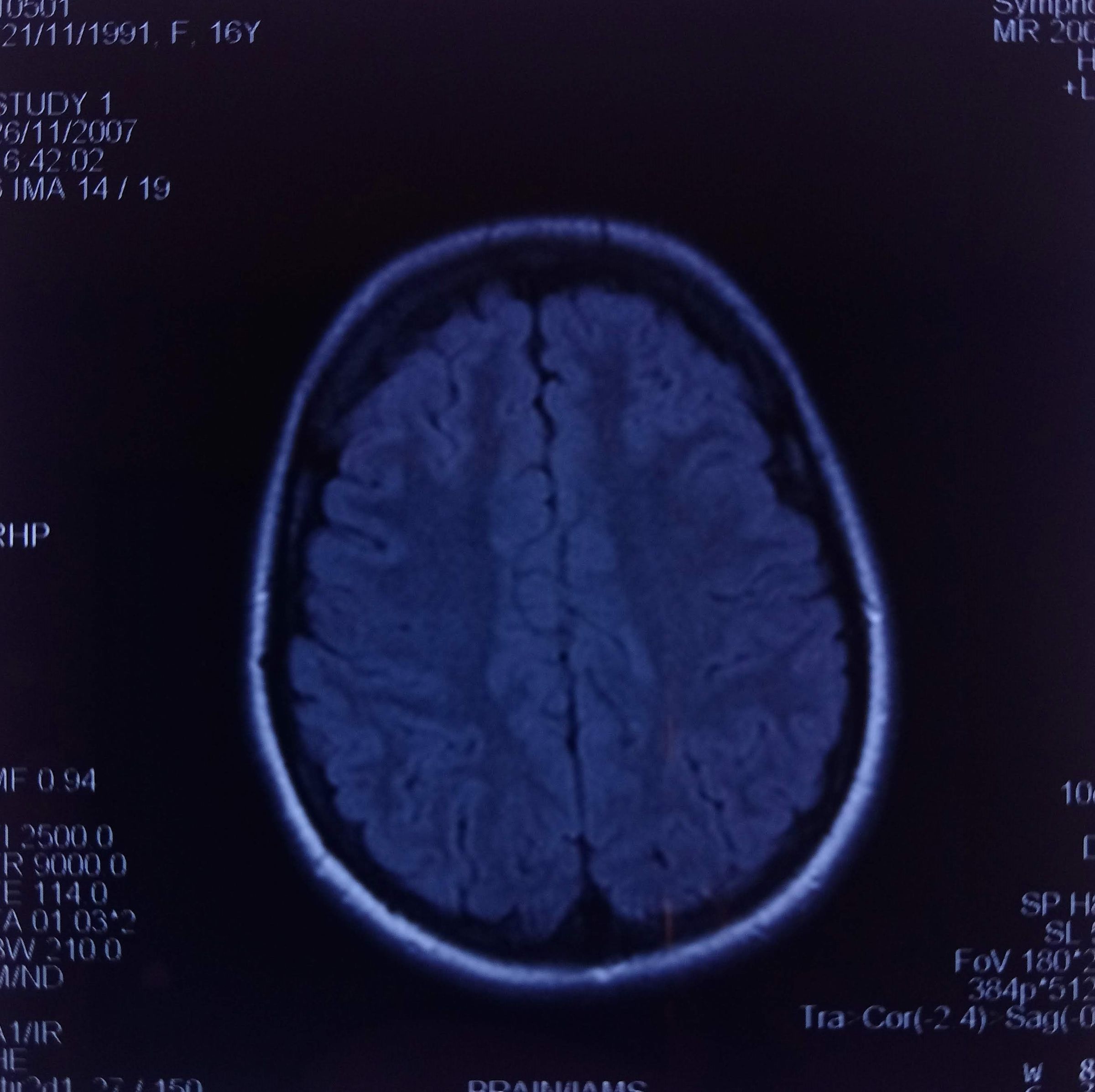 Mapping Your Mind- a Lesson on the Human Brain : 7 Steps - Instructables