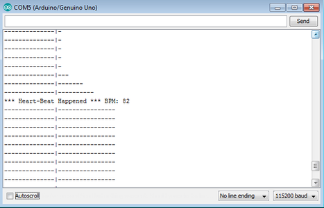 Pulse Sensor With Arduino Tutorial : 9 Steps (with Pictures ...