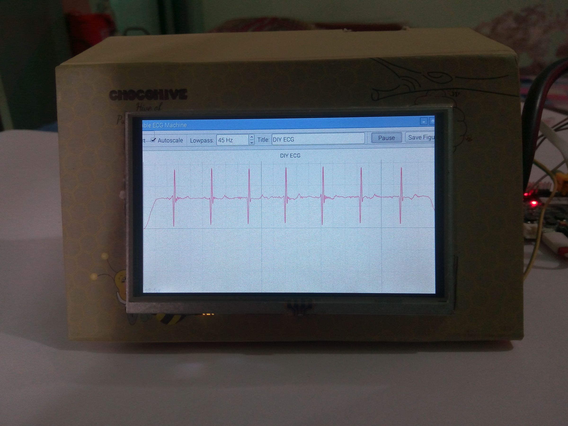Portable ECG Machine : 9 Steps (with Pictures) - Instructables
