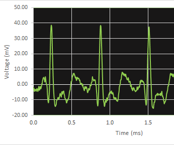 Simple ECG and Heart-Rate Detector : 10 Steps - Instructables