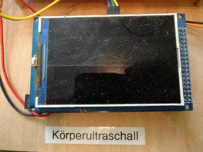 Body-ultrasound Sonography With Arduino : 3 Steps (with Pictures) - Instructables