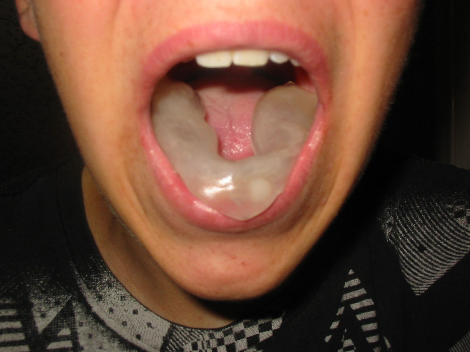 Make a Night Time Orthodontic Retainer : 3 Steps - Instructables