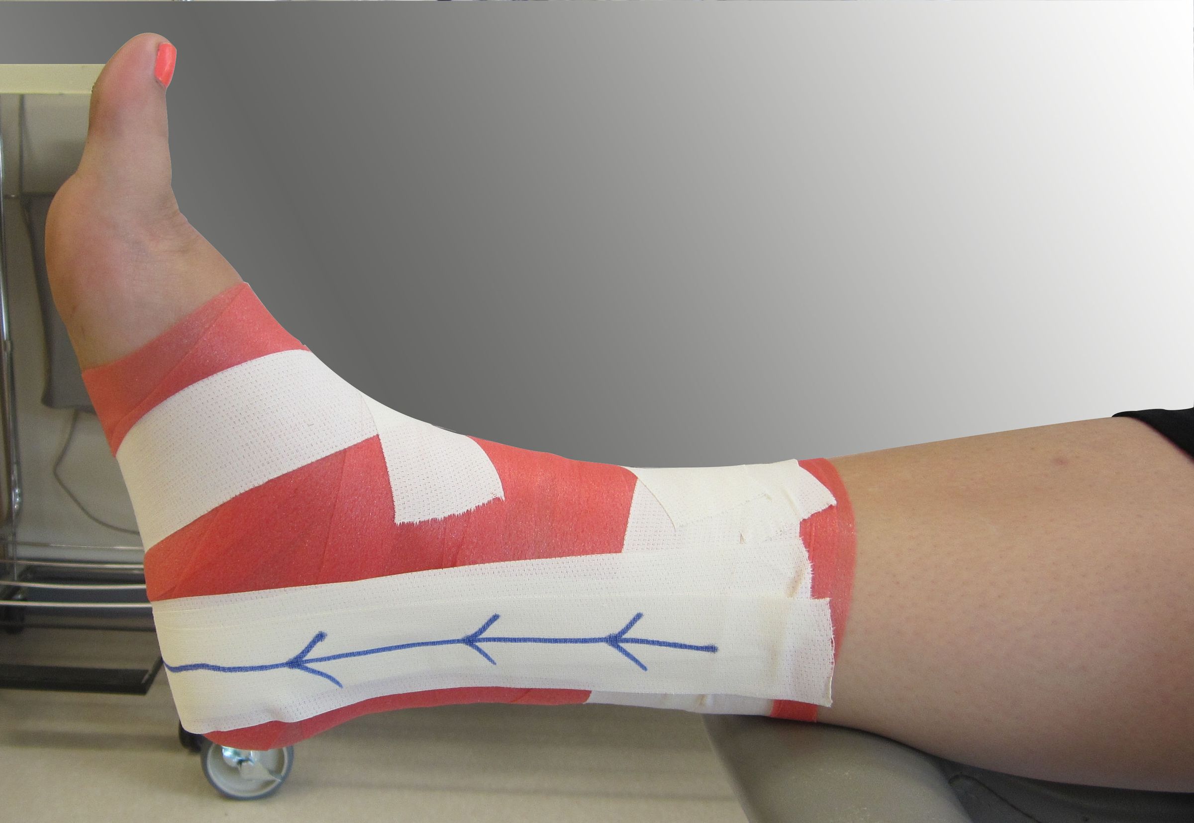 How to Tape an Ankle : 10 Steps - Instructables