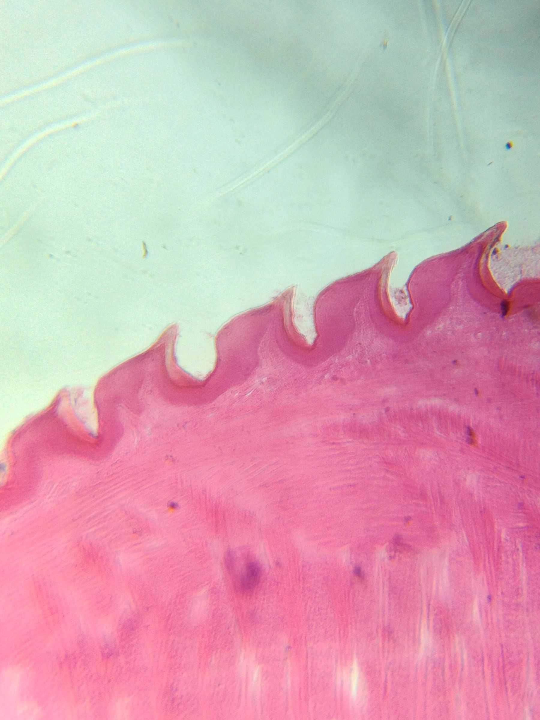 $10 Smartphone to Digital Microscope Conversion! : 9 Steps (with ...