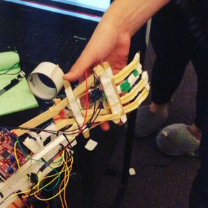 DIY Prosthetic Hand : 7 Steps (with Pictures) - Instructables