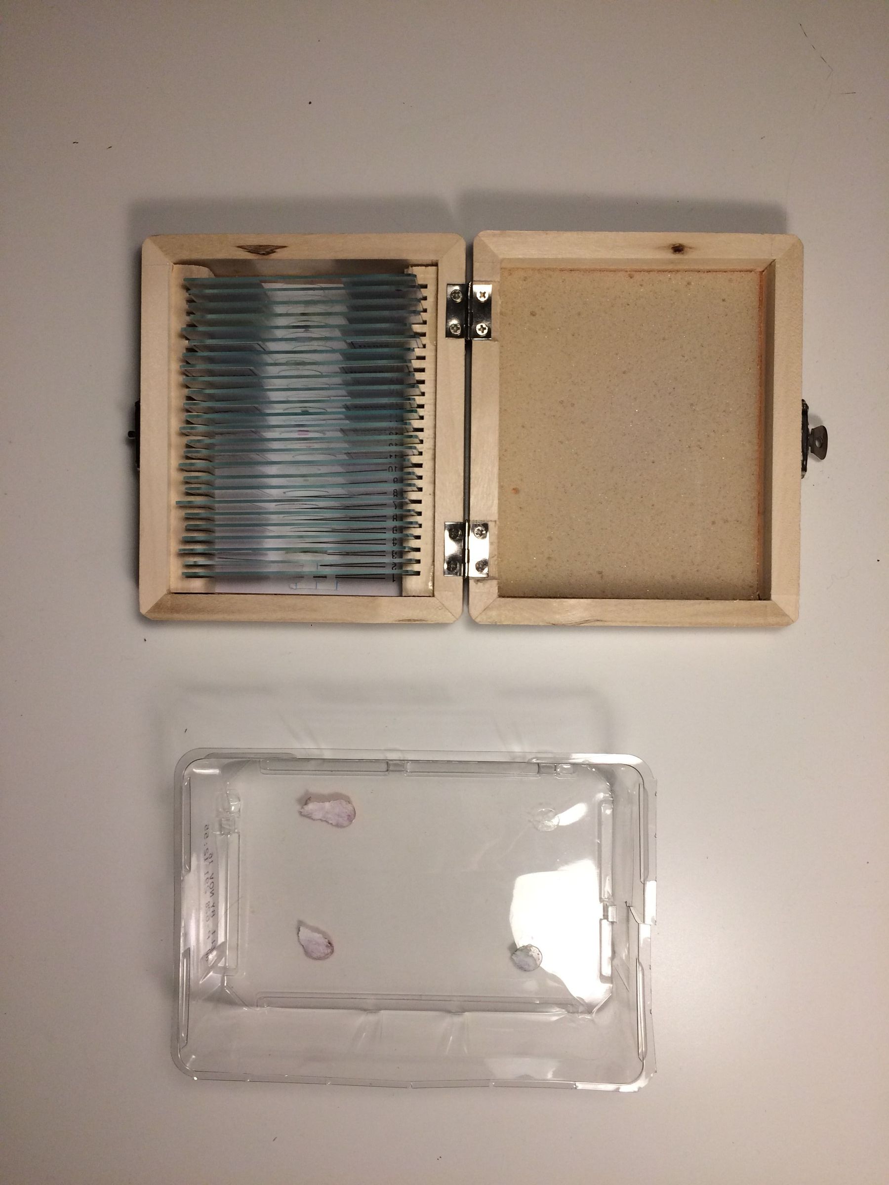 Low-cost Fluorescence and Brightfield Microscopes : 9 Steps (with ...