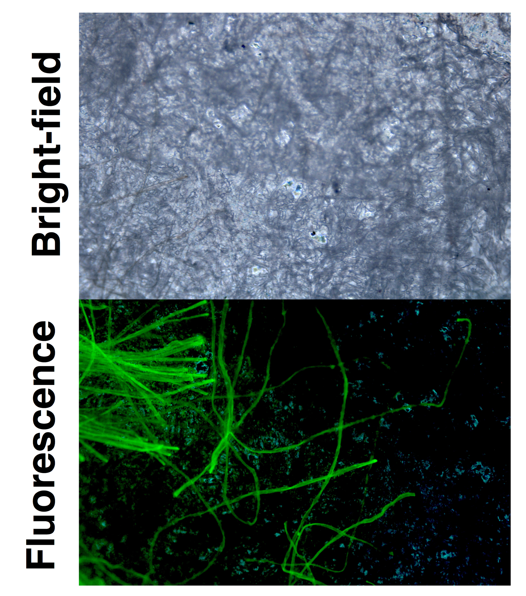 Low-cost Fluorescence and Brightfield Microscopes : 9 Steps (with ...
