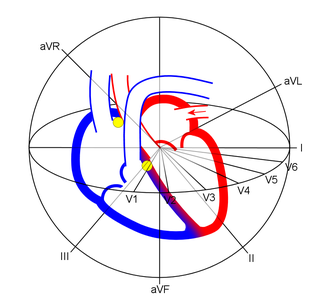 ECG Display With Arduino : 13 Steps (with Pictures) - Instructables