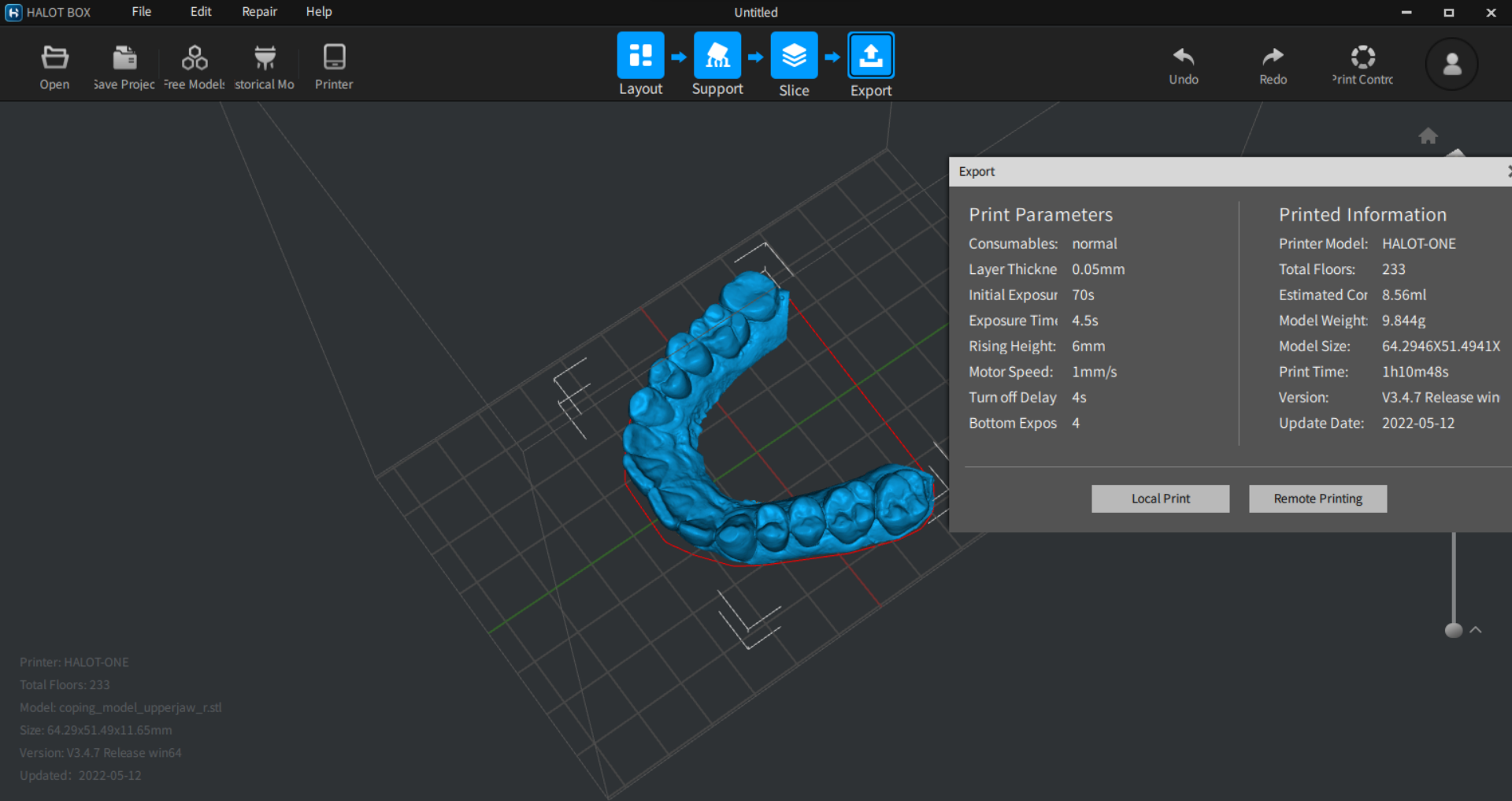 AI-driven Dental Cast (Model) Classifier W/ Edge Impulse : 19 Steps ...