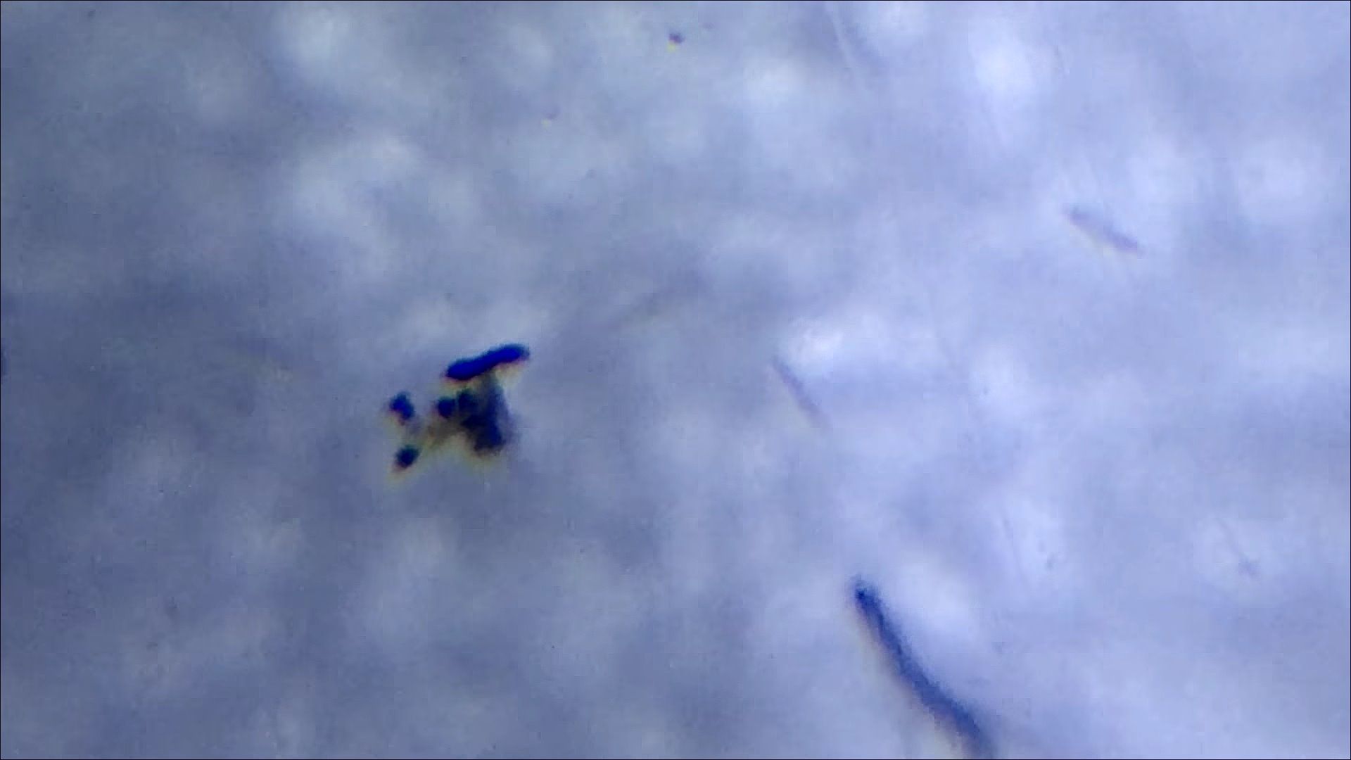 DIY Microscope Using Smartphone : 5 Steps (with Pictures) - Instructables