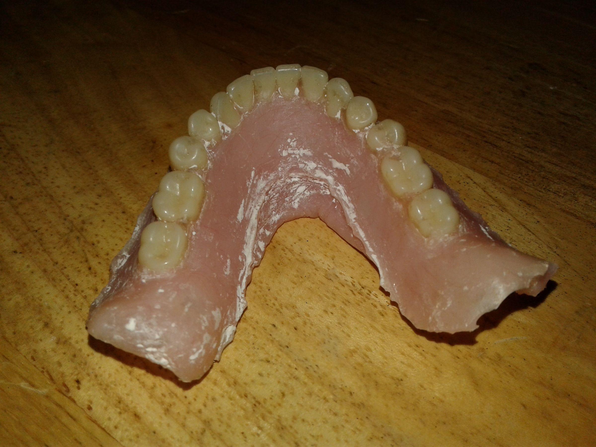 DIY Dentures : a Post-Surgical Plan : 12 Steps (with Pictures ...
