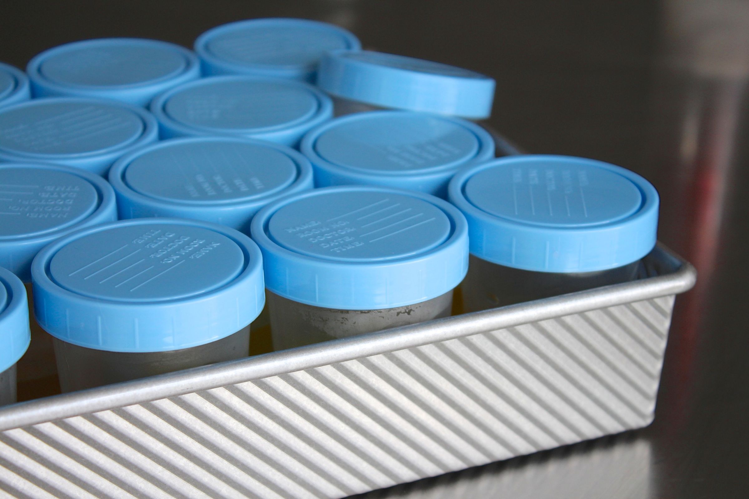 Urine Test Jell-o Shots : 6 Steps (with Pictures) - Instructables